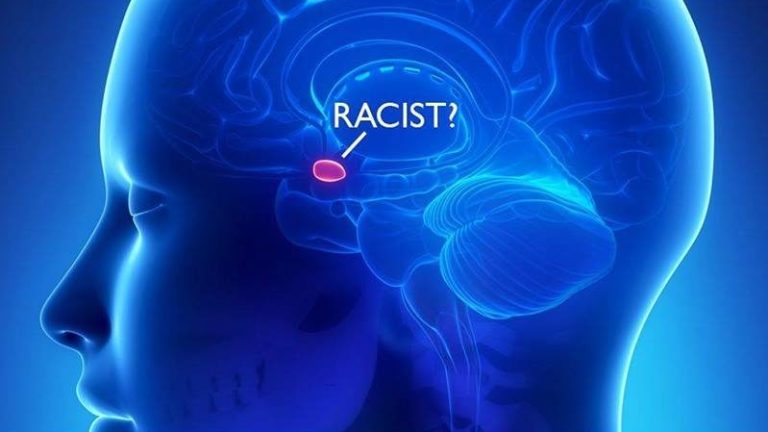 You and Your Racist Brain: The Neuroscience of Prejudice - Inspiring ...